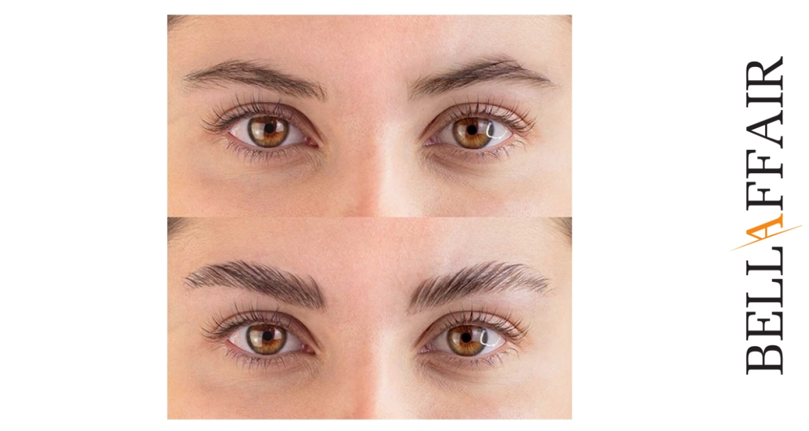 Fleeky Browlift Kit Maxi - da acquistare online | BellAffair.it